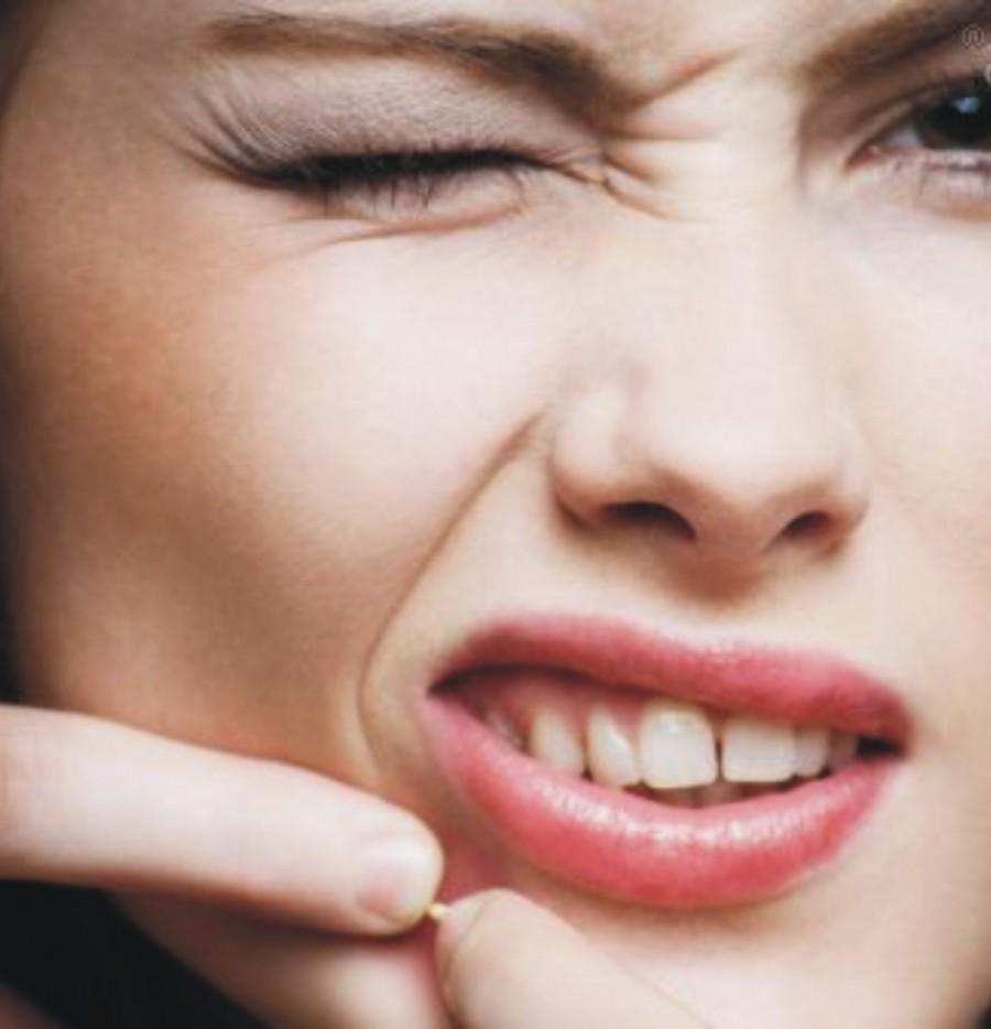 Scuame si roseata? E posibil sa ai acnee rozacee! | Antena 1