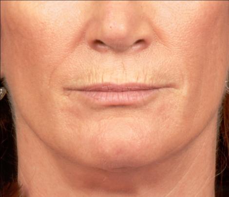 riduri - citeste toate articolele despre riduri | Pagina 1 din 4 | Antena 1