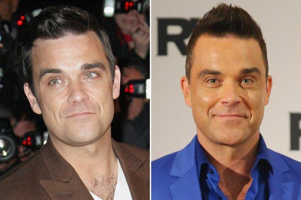 Robbie Williams: „Nu îmi mai pot mișca fruntea din cauza atâtor ...