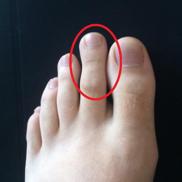 Degetele la control! Ce se spune despre oamenii care au al doilea deget ...