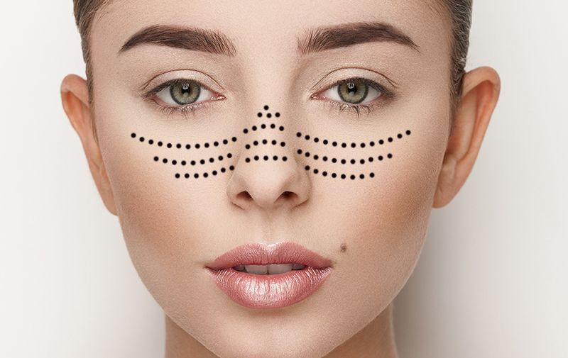 Intervenții estetice pentru tratarea cearcănelor și a pungilor de sub ...