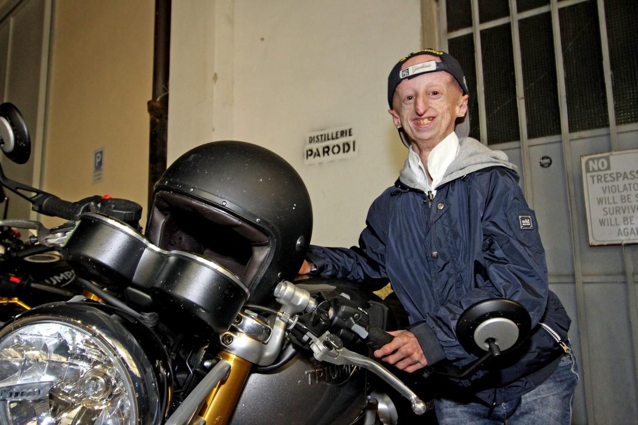 Sammy Basso este cea mai în vârstă persoană care suferă de Progeria ...