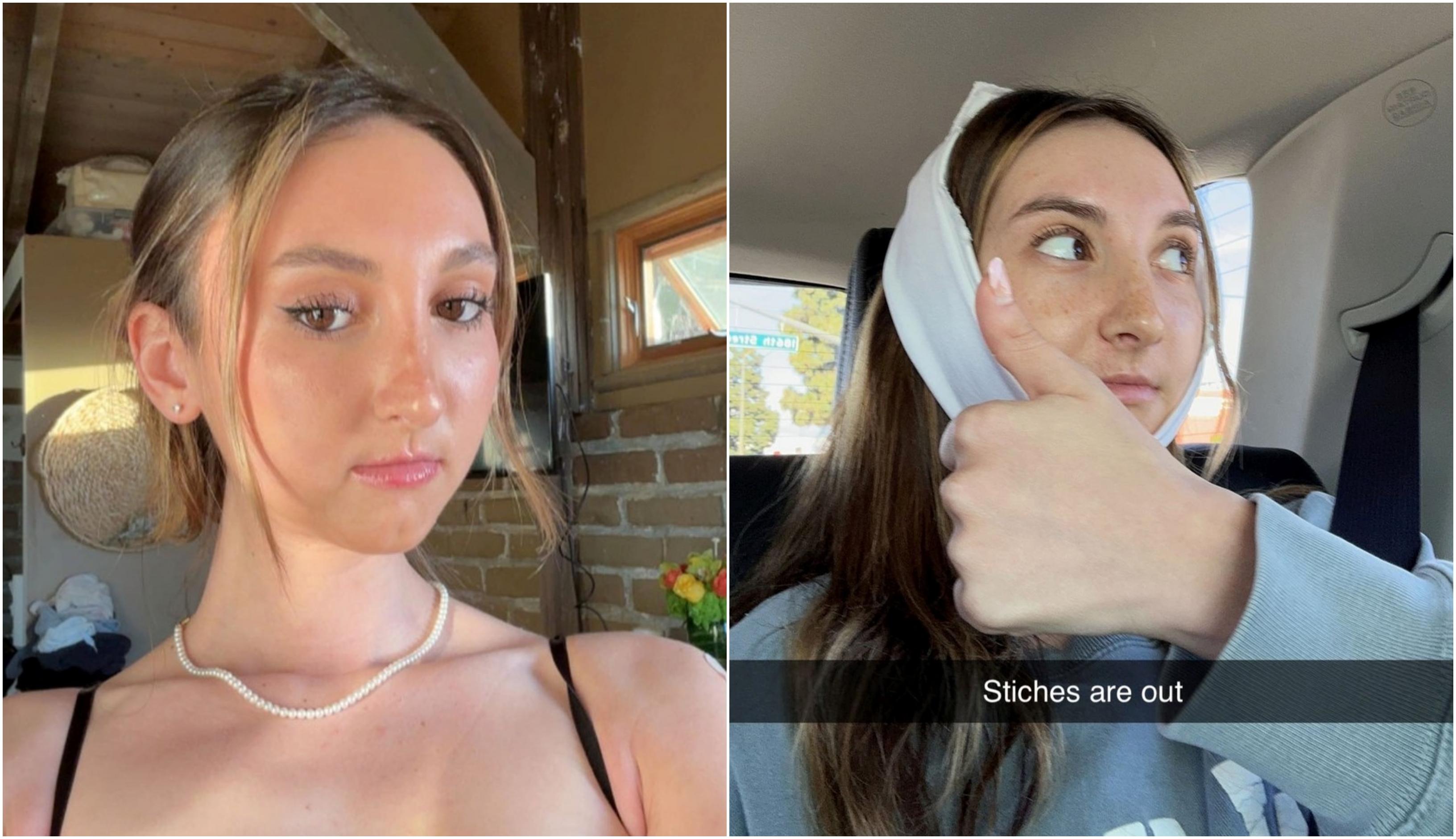 Tânăra comparată cu o veveriță a trecut printr-o transformare uluitoare. Cum arăta „fără bărbie ...