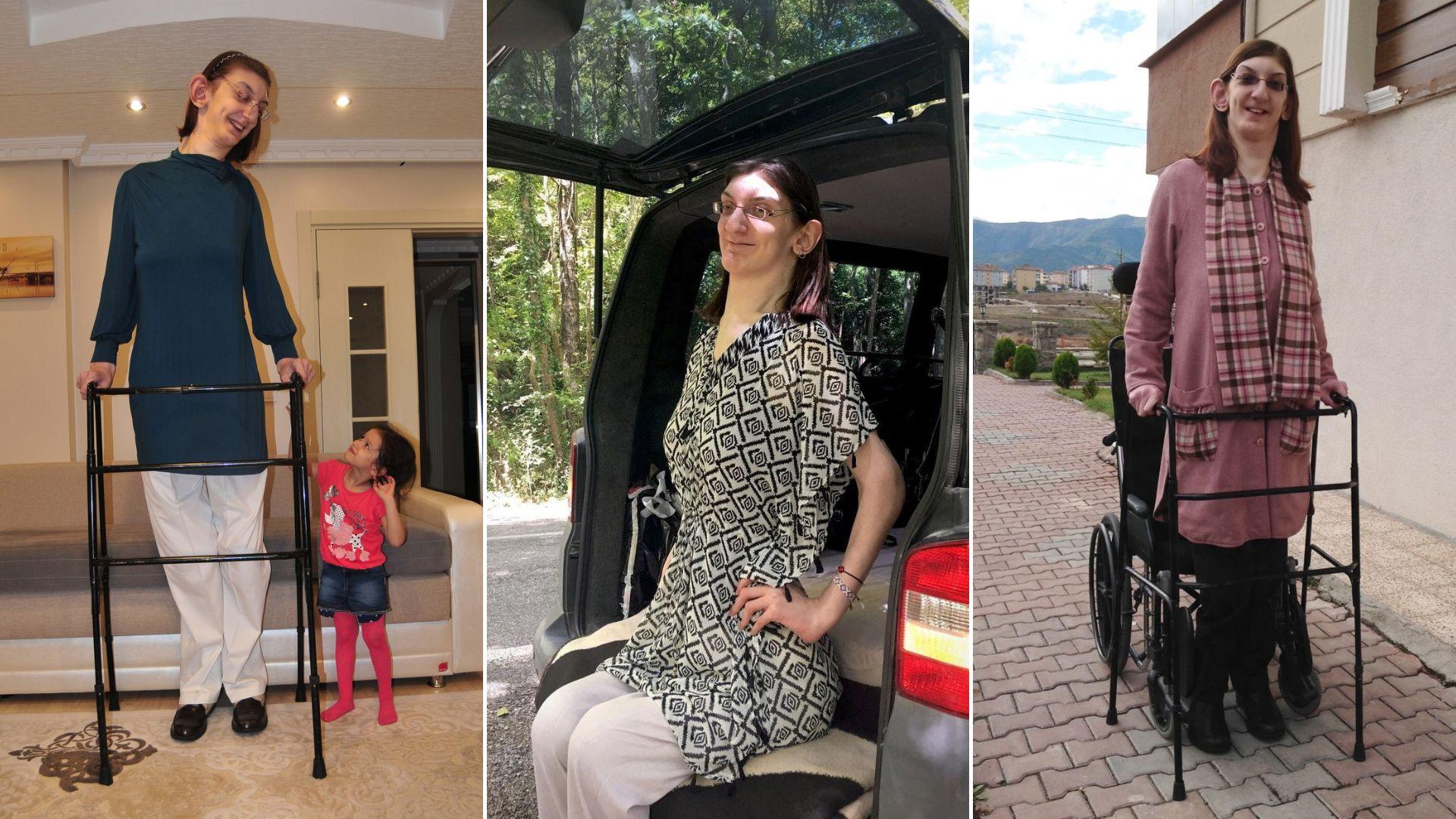 Cum trăiește cea mai înaltă femeie din lume. Rumeysa Gelgi are 2,16 metri și doar 27 de ani ...