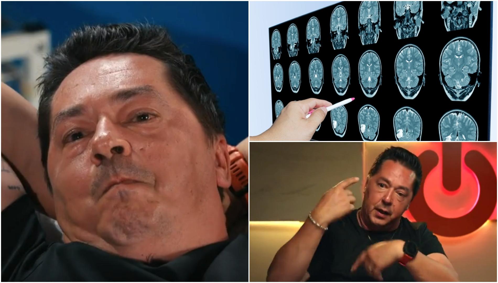 Ce este Sindromul Cluster, de care a suferit Sorin Gonțea de la Power Couple România. Durerea e ...