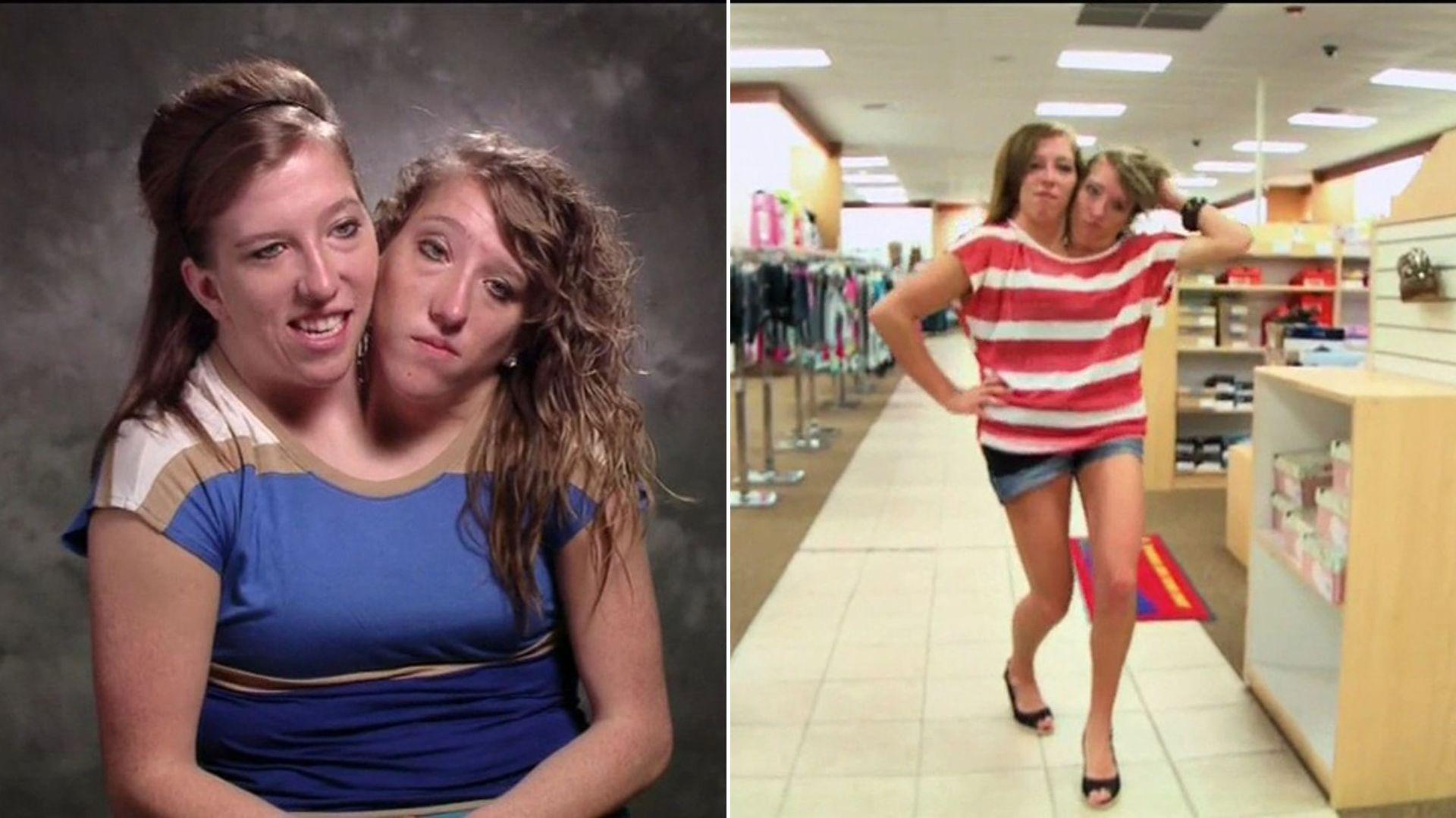 Geamăna siameză Abby Hensel s-a căsătorit. Imagini cu ea și sora ...